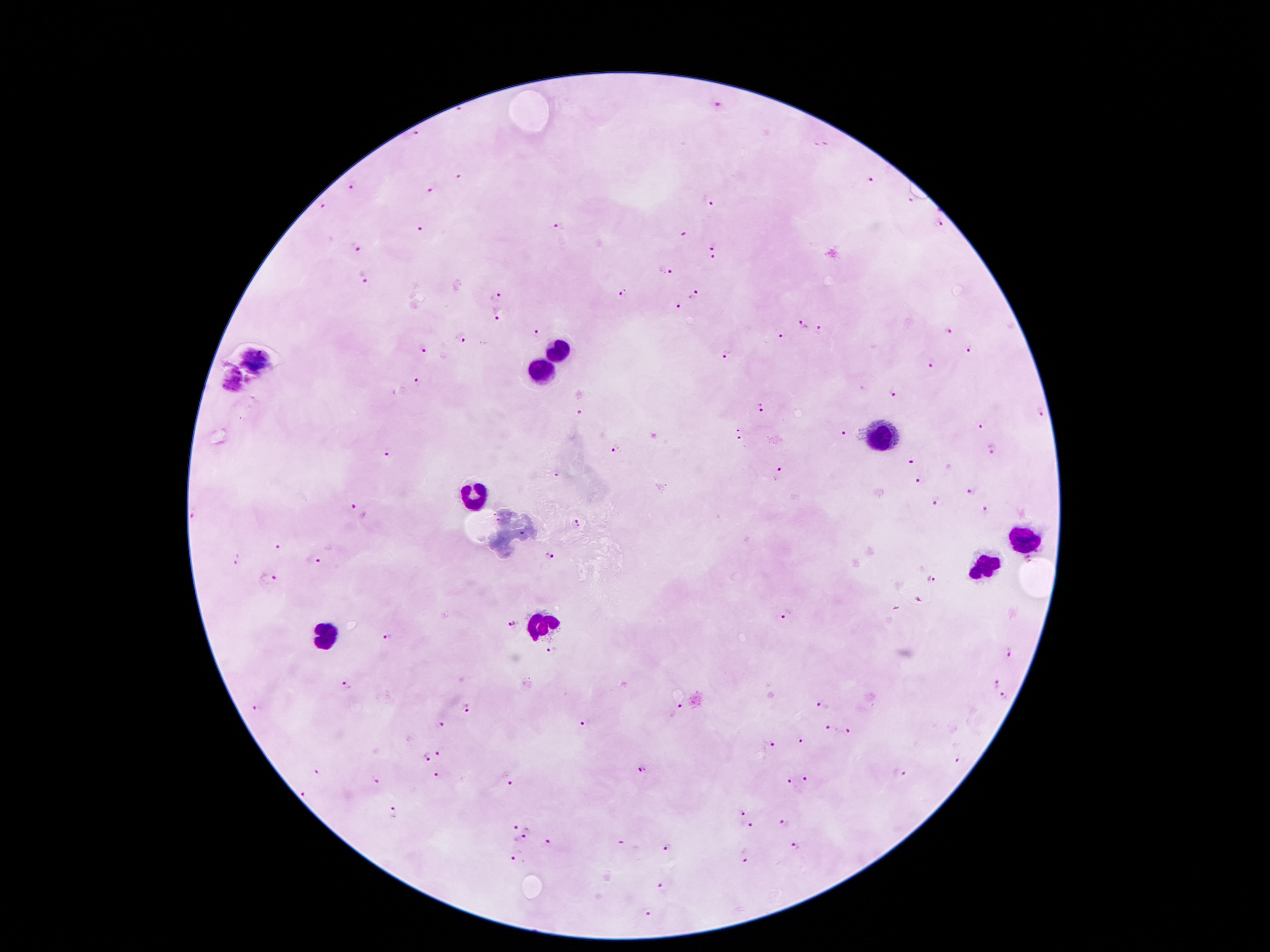 Malaria Object Detection Dataset By Malaria