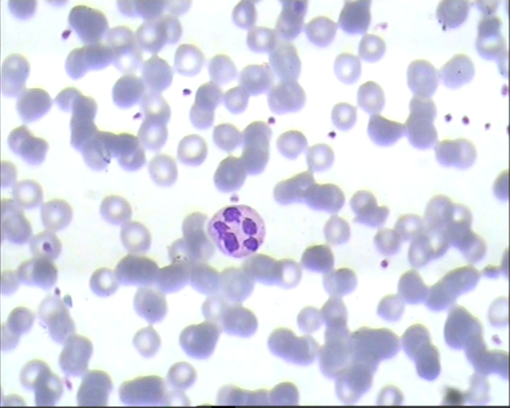 WBC LISC Object Detection Dataset by WBCs