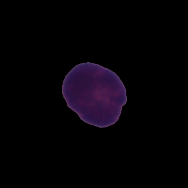 Acute Lymphoblastic Leukemia Object Detection Dataset By Final Year Project
