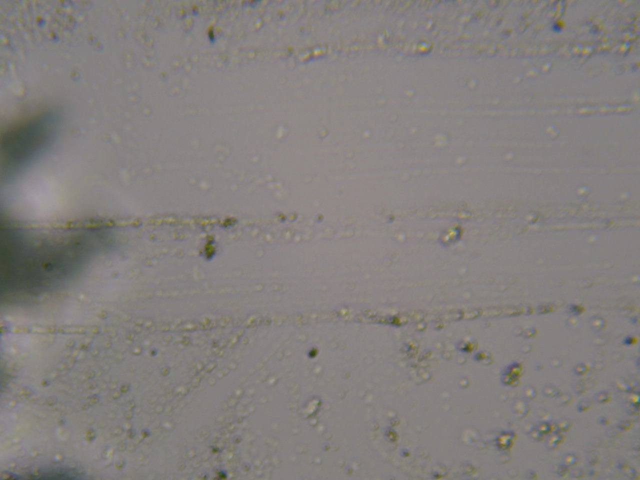 microscope sperm Object Detection Dataset by spermdetection