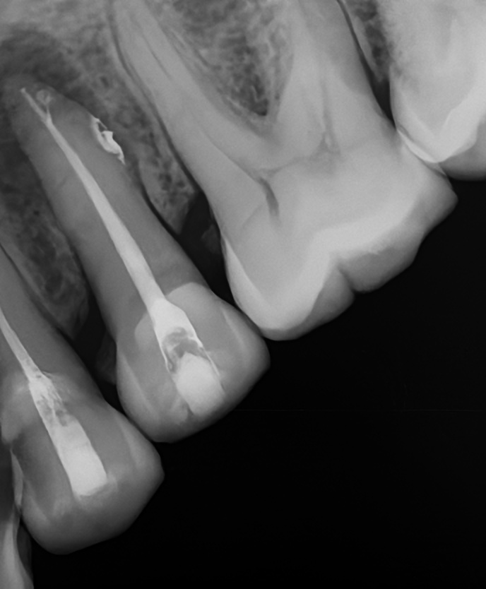 dent_test Instance Segmentation Dataset by kagglemammo
