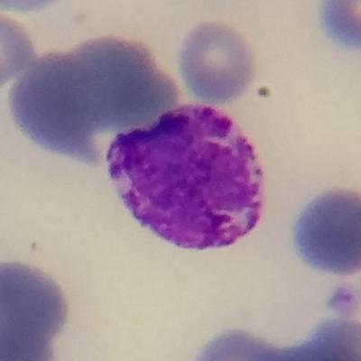 Blood_cells Object Detection Dataset by Workspace01