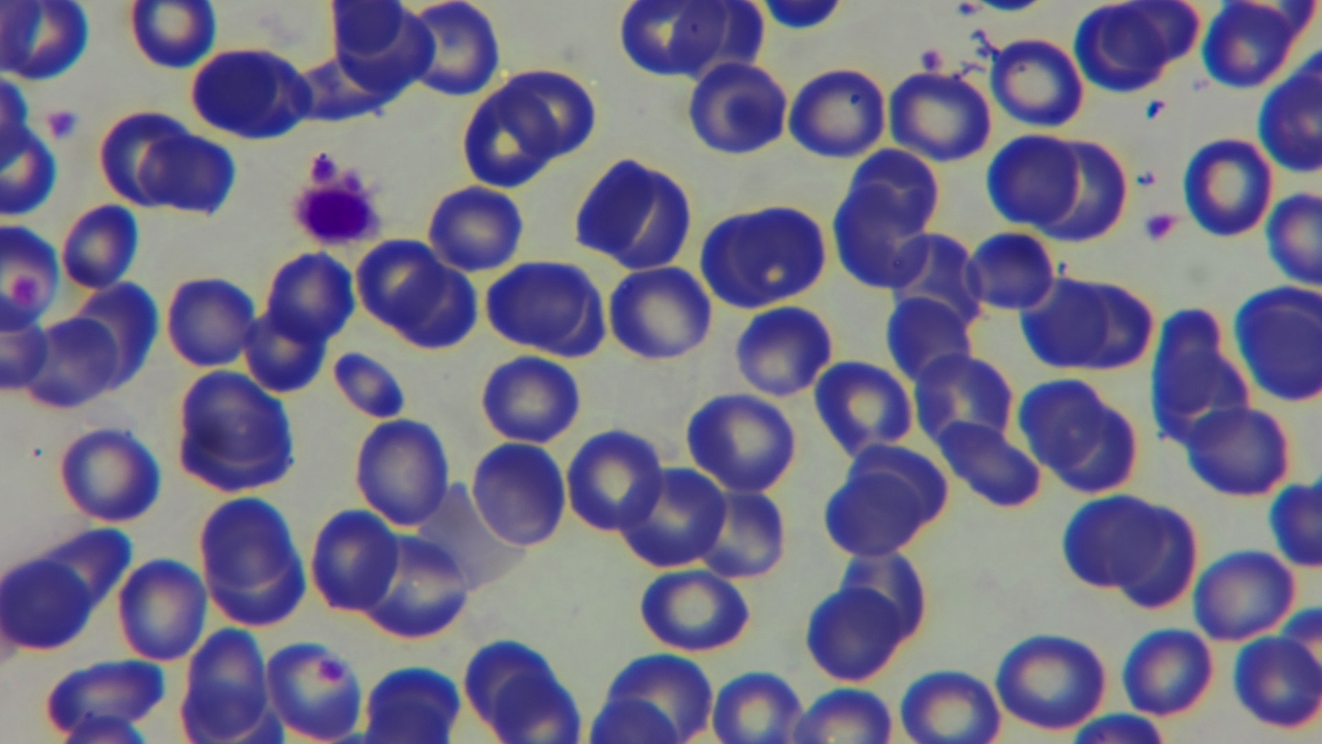 Smart Automation Blood Detection Instance Segmentation Dataset by Inbiomed