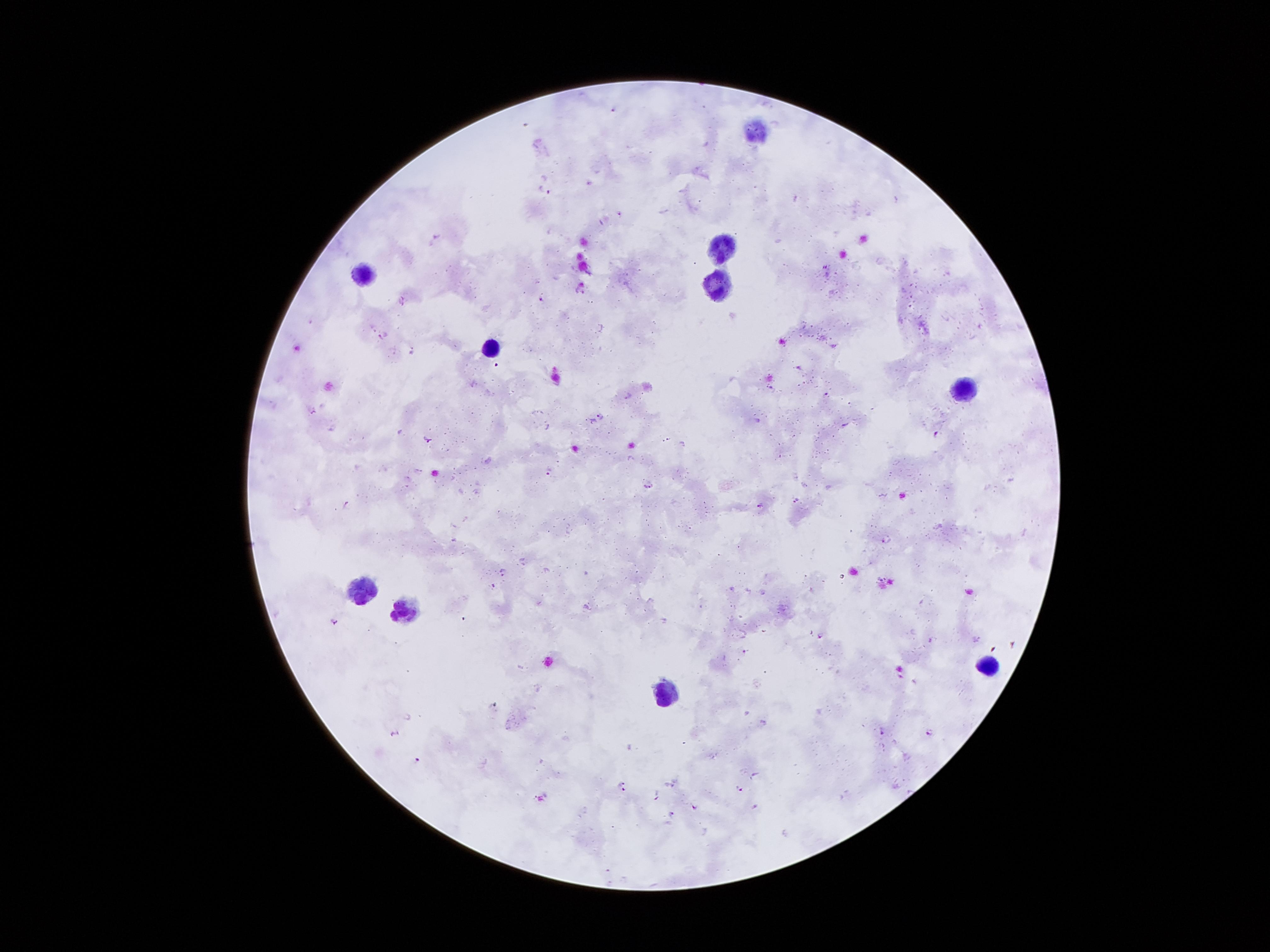 Malaria Detector Object Detection Dataset By Malariamodel