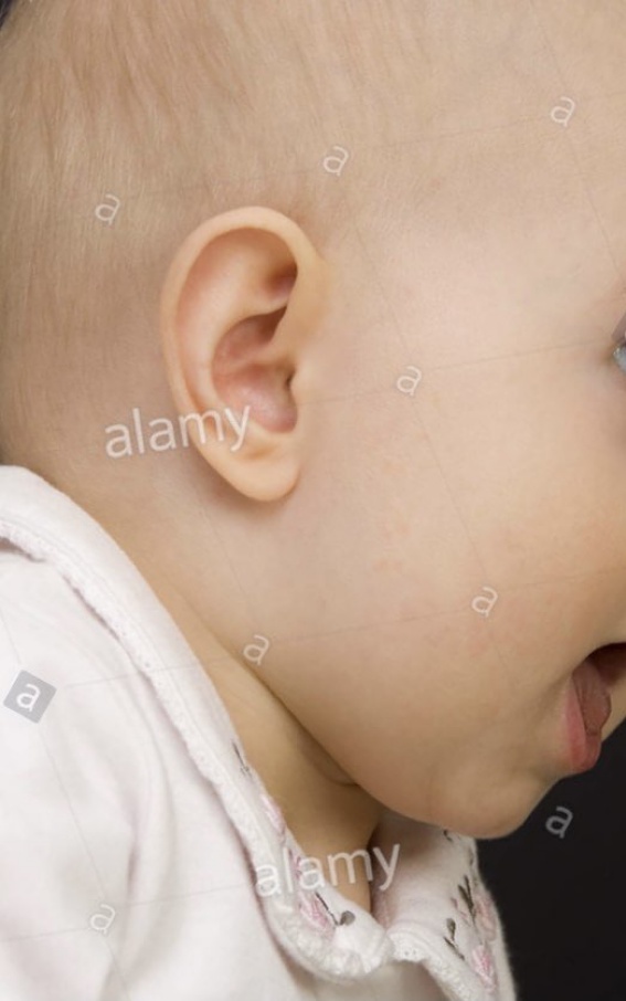 Right Ear Object Detection Dataset By Ear Detection