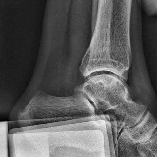 Spraindetection Object Detection Dataset By Workspace1