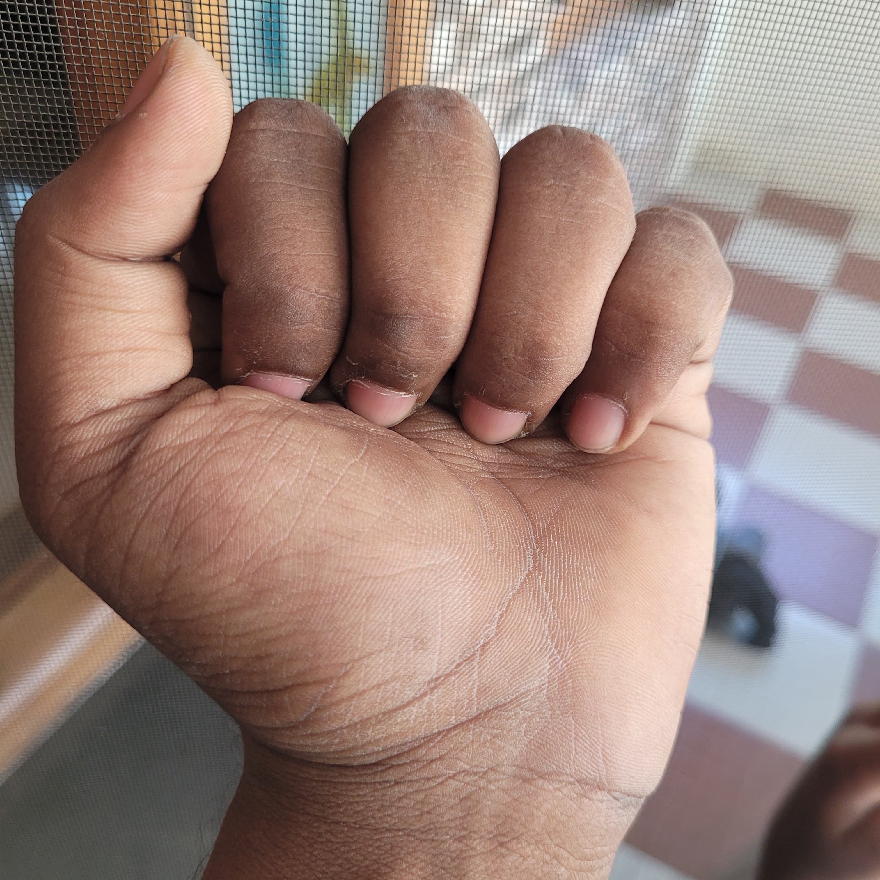 alwin (alwin-7fsve) - Roboflow Universe