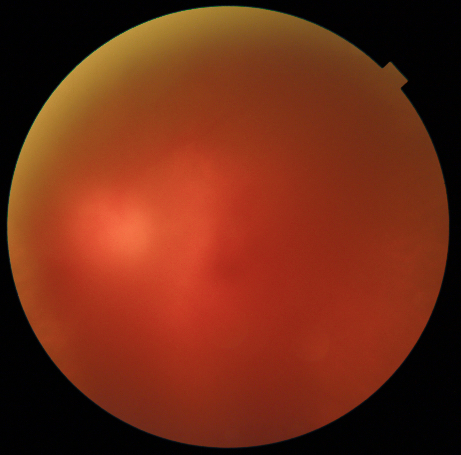 Macula and Optic Disc Detection Object Detection Dataset by CILS Macula and Optic Disc Detection Object Detection Dataset by CILS