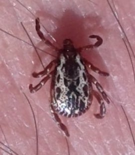tick id Object Detection Model by Christopher