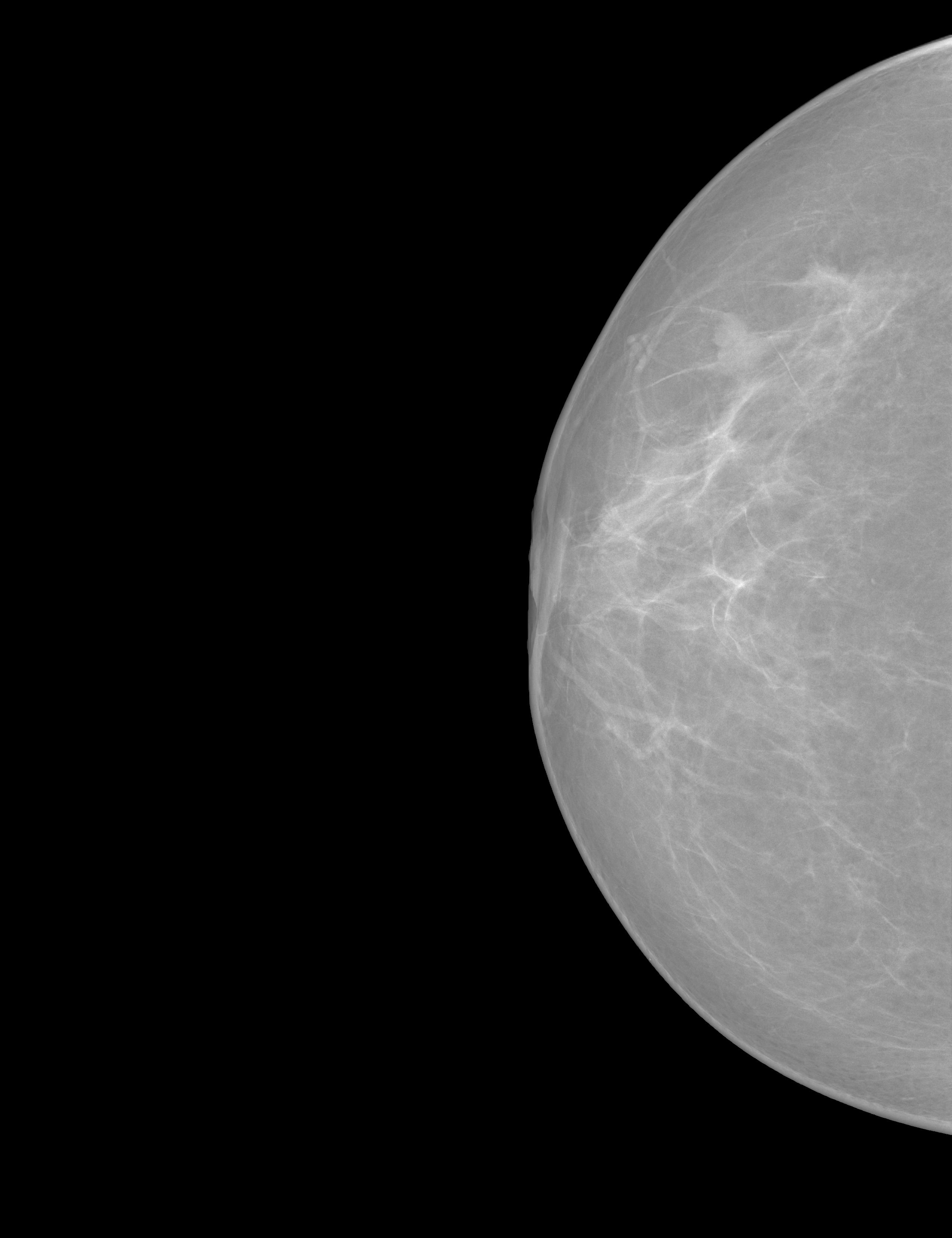 INBREAST DATASET Object Detection Model by Mepco