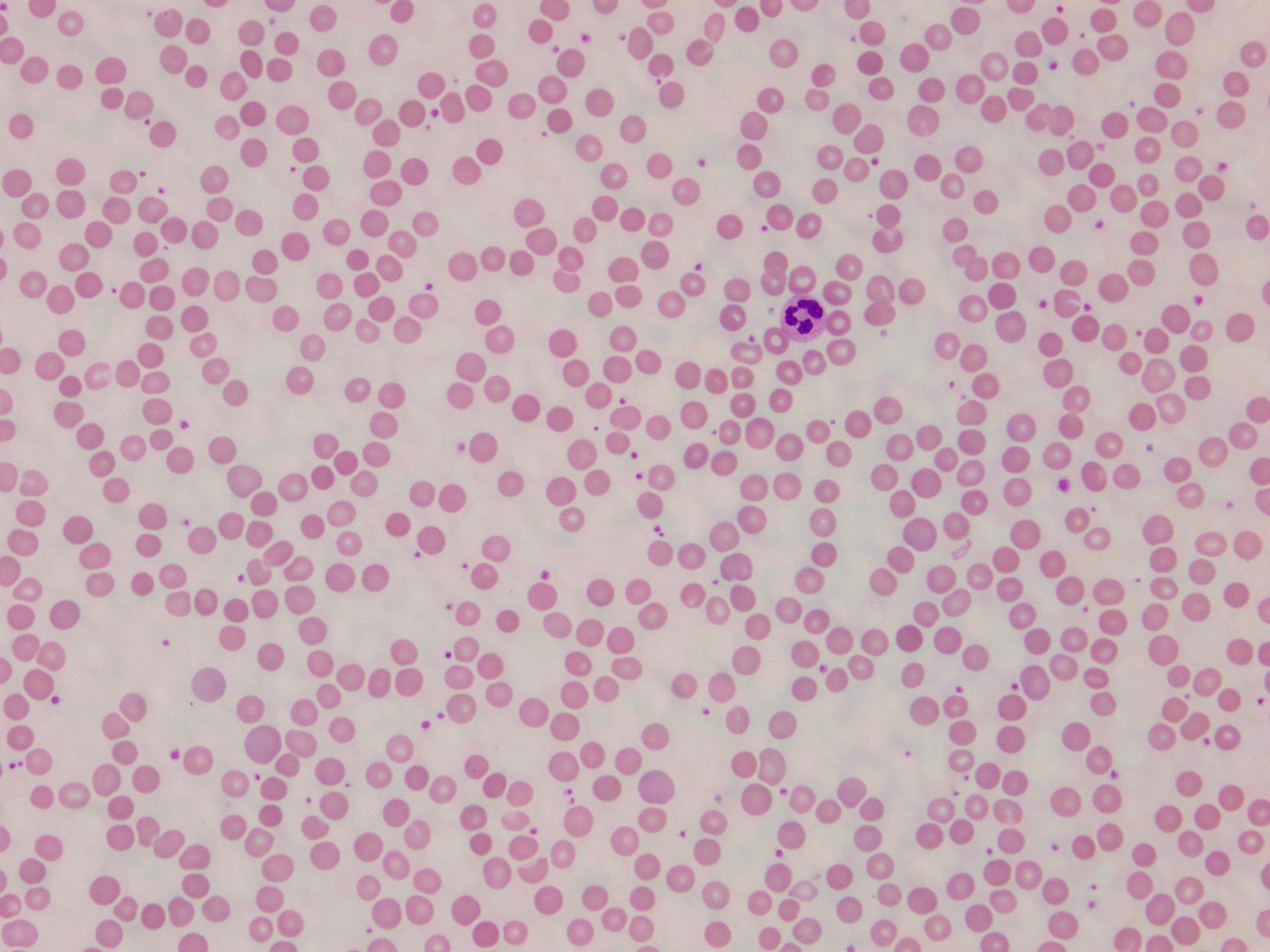 LUKEMIA Object Detection Model by TEST