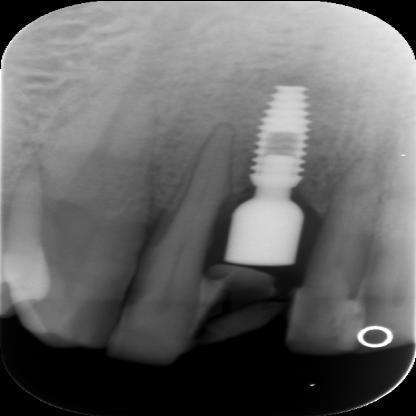 bitirme_projesi Object Detection Dataset and Pre-Trained Model by meraldanma