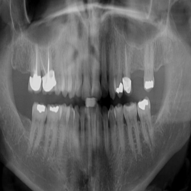 Bitirme Projesi 2 Object Detection Dataset And Pre Trained Model By Meraldanma