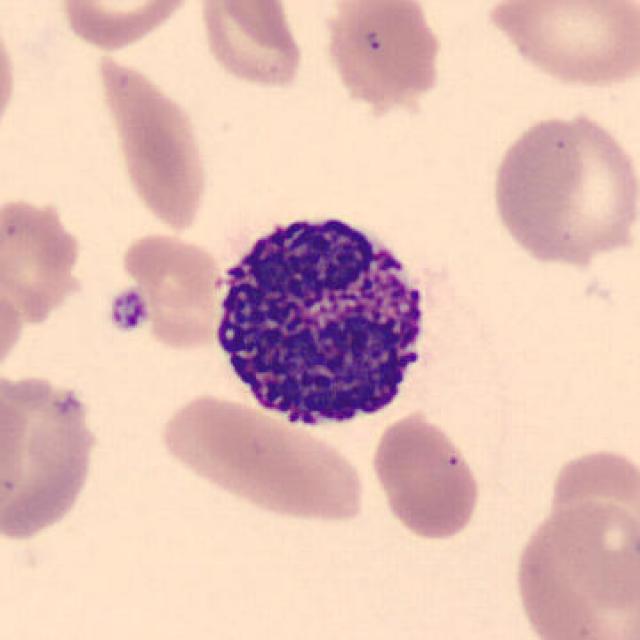 Blood Cell Abnormality Detection Object Detection Dataset and Pre ...