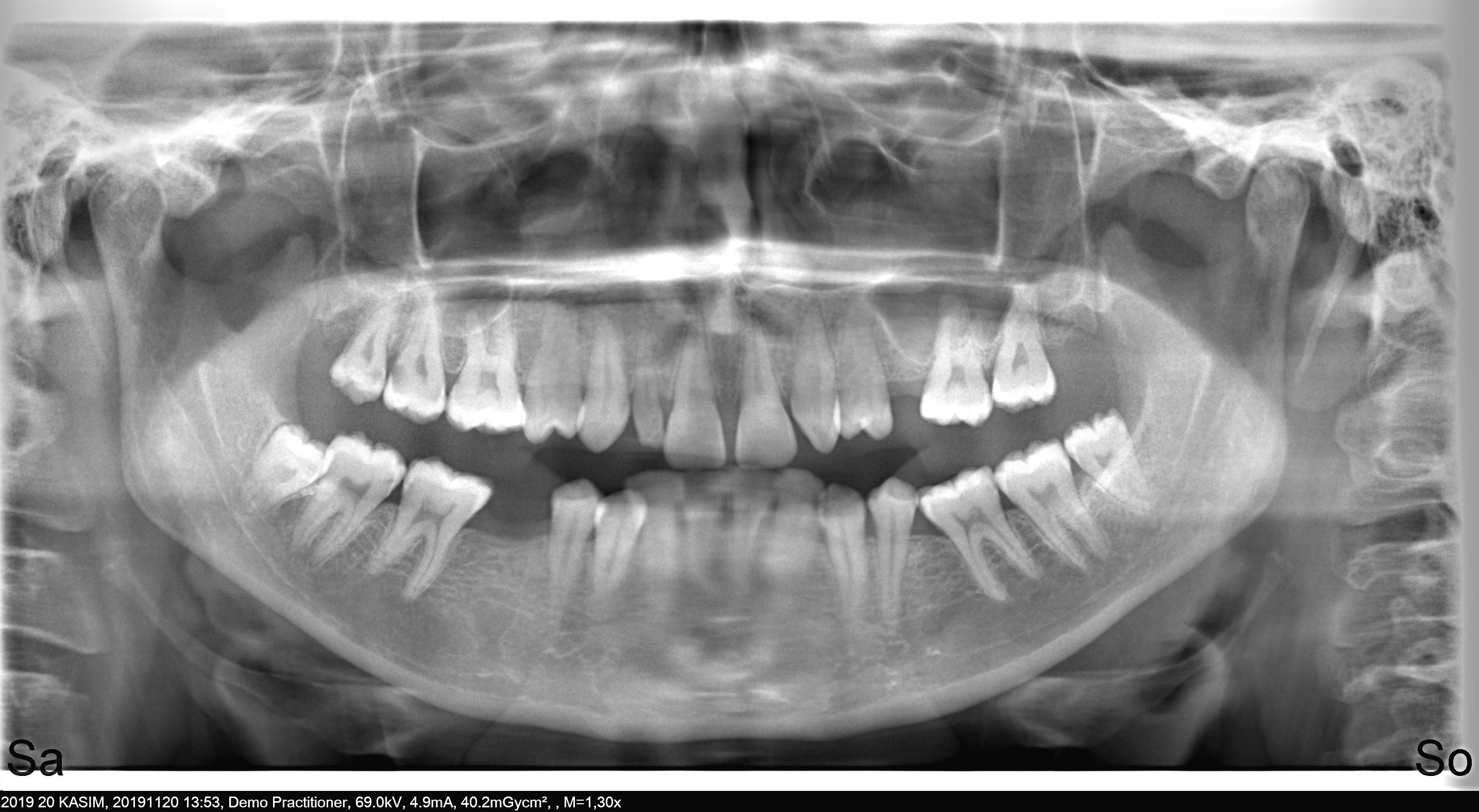 Dental Object Detection Object Detection Dataset By Bsai