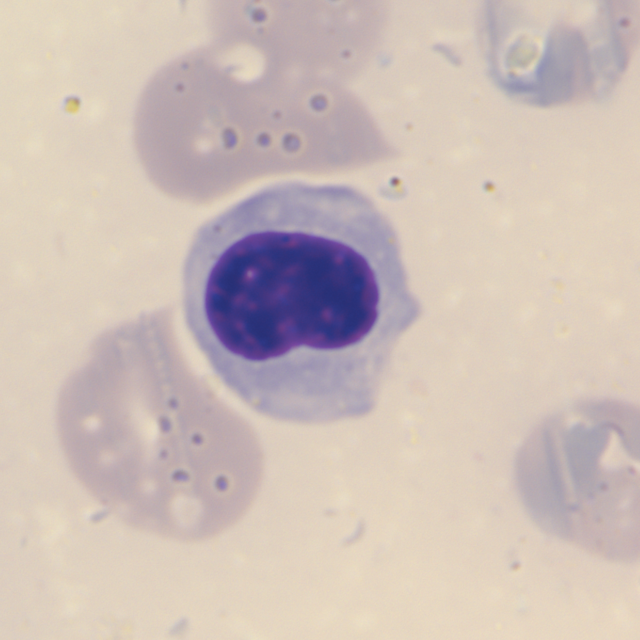 White Blood Cells Object Detection Dataset by DrAtulTiwari