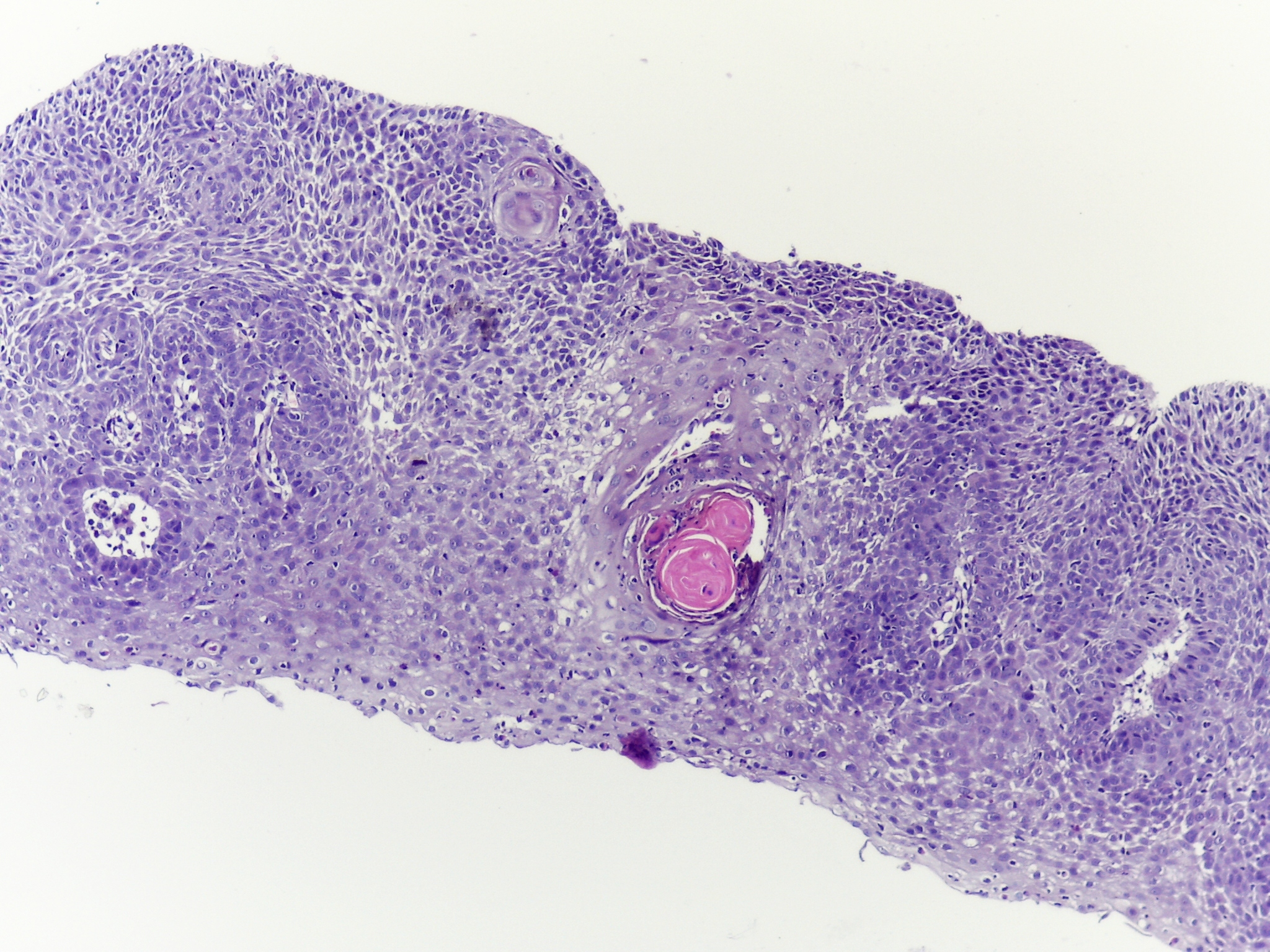 oral_cancer Classification Model by cancerresearch