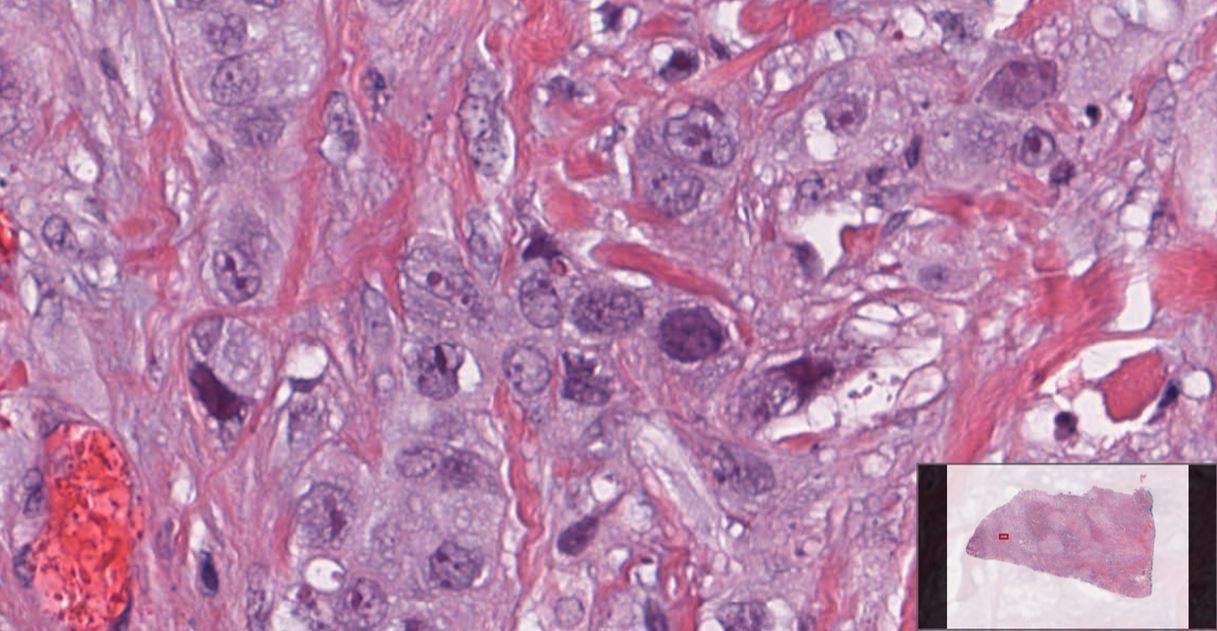 The Cancer Genome Atlas (TCGA) Object Detection Model by The Cancer ...