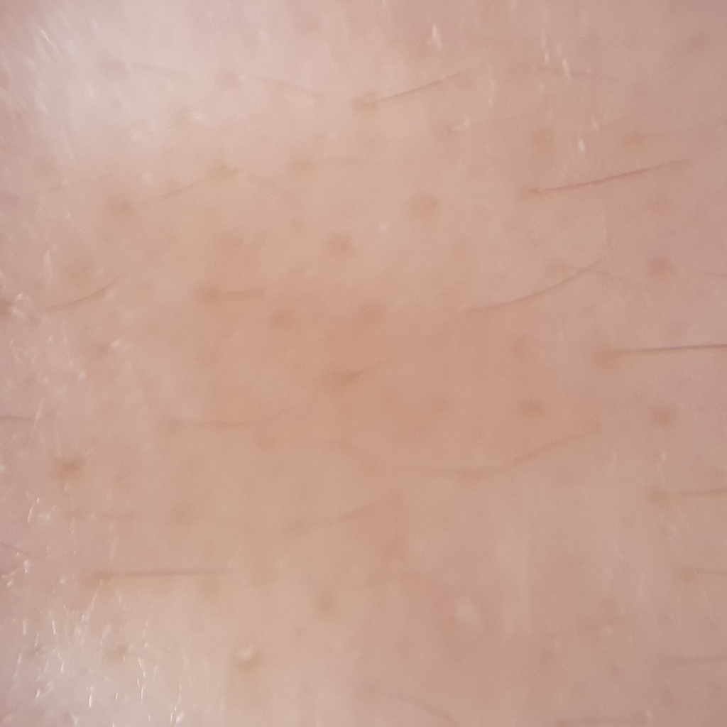 seg pore Instance Segmentation Model by foodrecog