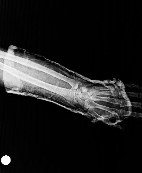 Ulna Object Detection Dataset By Van Yyu