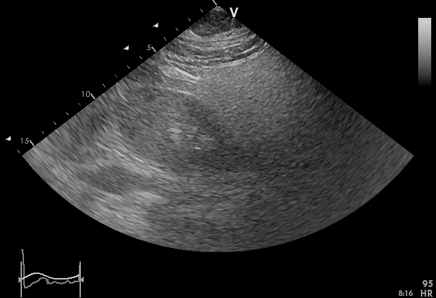 Liver Ultrasound Semantic Segmentation Semantic Segmentation Dataset by ...