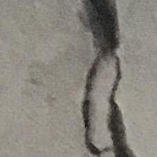 crack_detection Object Detection Dataset and Pre-Trained Model by crack ...