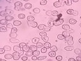 Microcyto Object Detection Dataset by microcytic