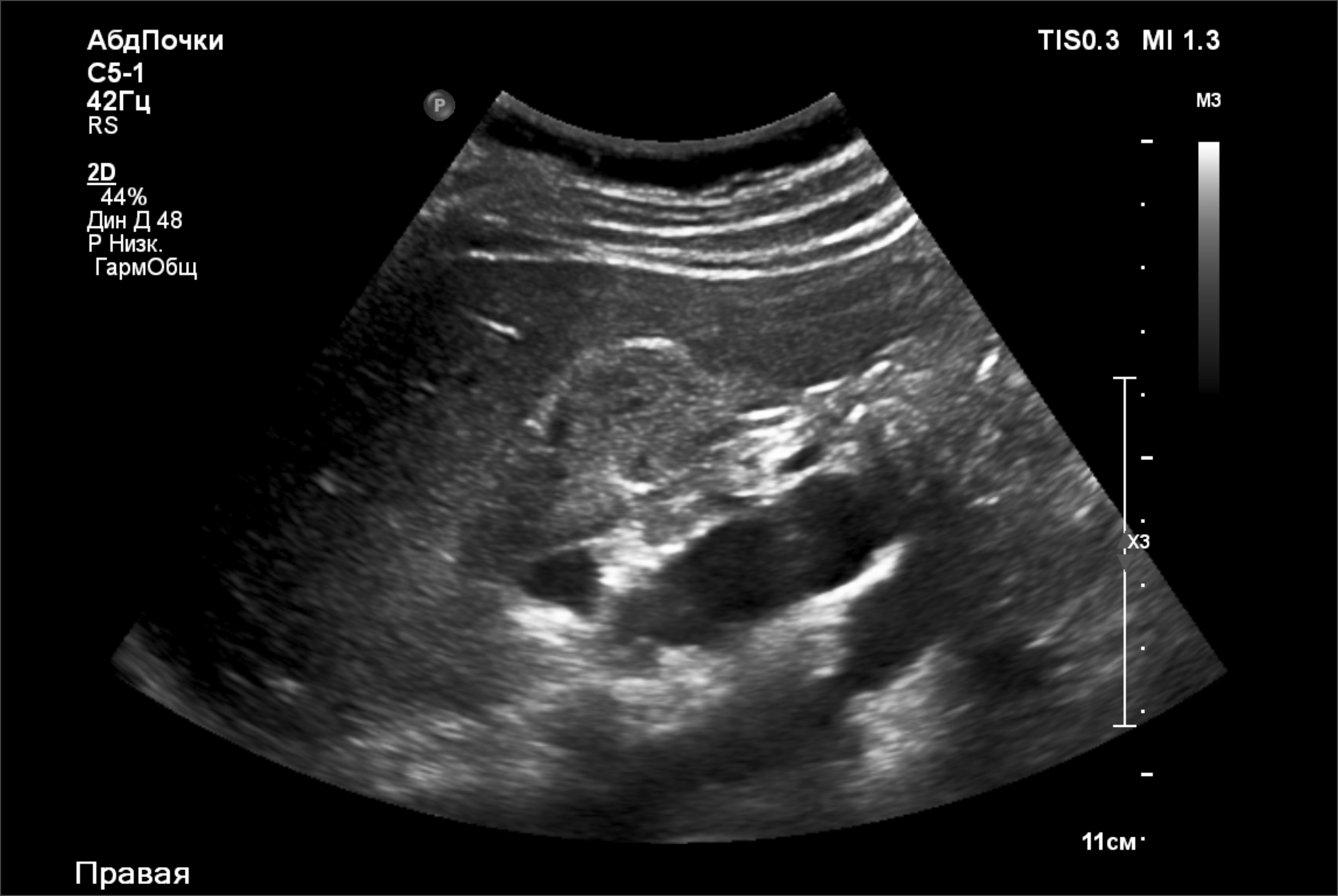 Tumor And Other Object Detection Dataset And Pre Trained Model By Project C4uqk