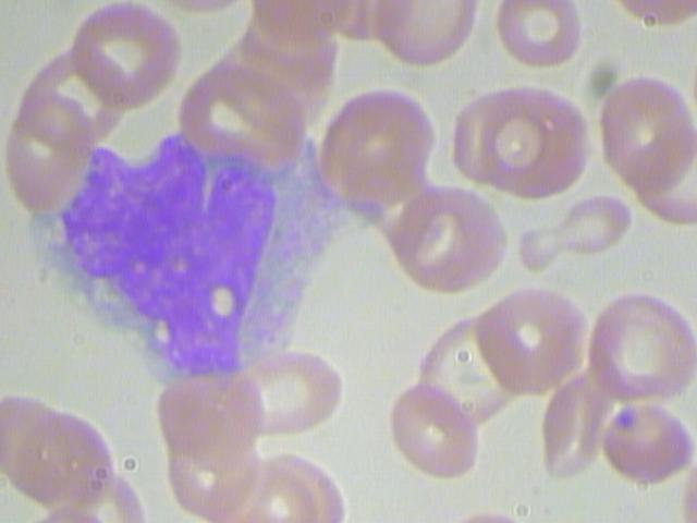 WBC Object Detection Dataset by airports