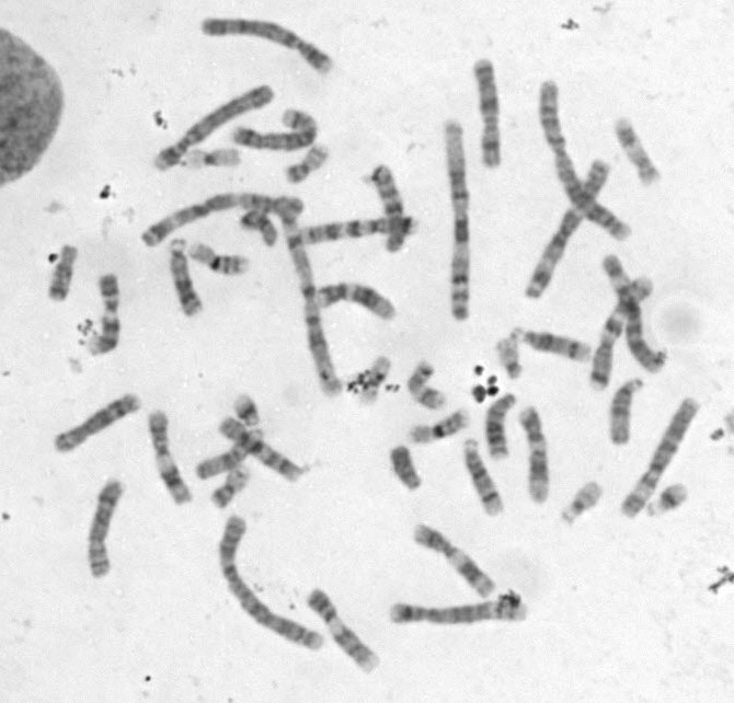 Chromosome Instance Segmentation Model by project