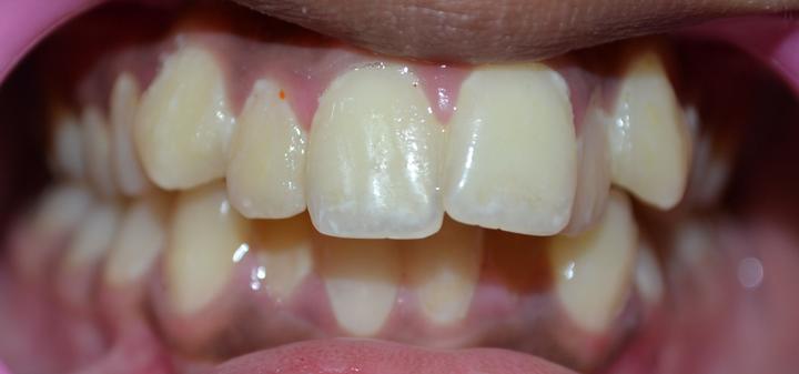 Tooth-v3 Classification Dataset by shayan 3