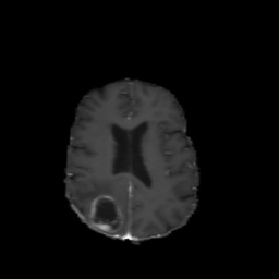 brain Object Detection Model by usa
