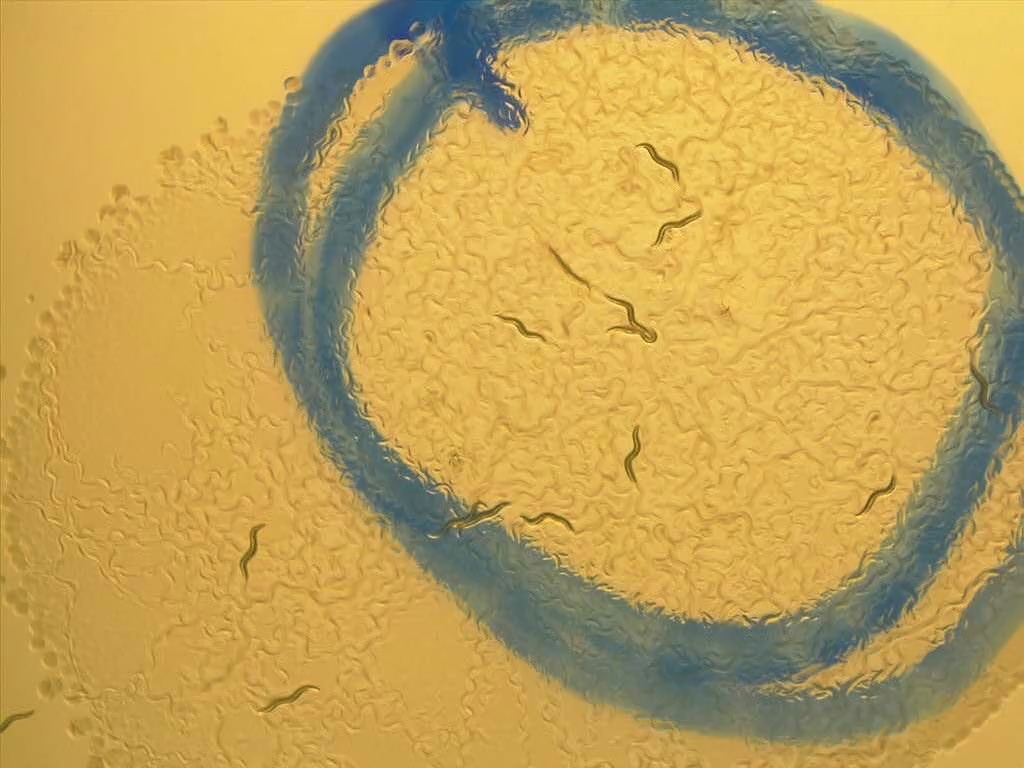 Worm Tracking Object Detection Dataset And Pre Trained Model By Worm 0975