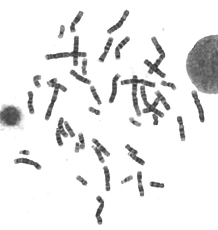 c2 Object Detection Dataset by Cromosomas