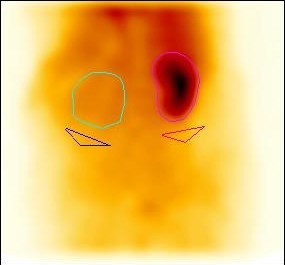 How to Use the detection Instance Segmentation API