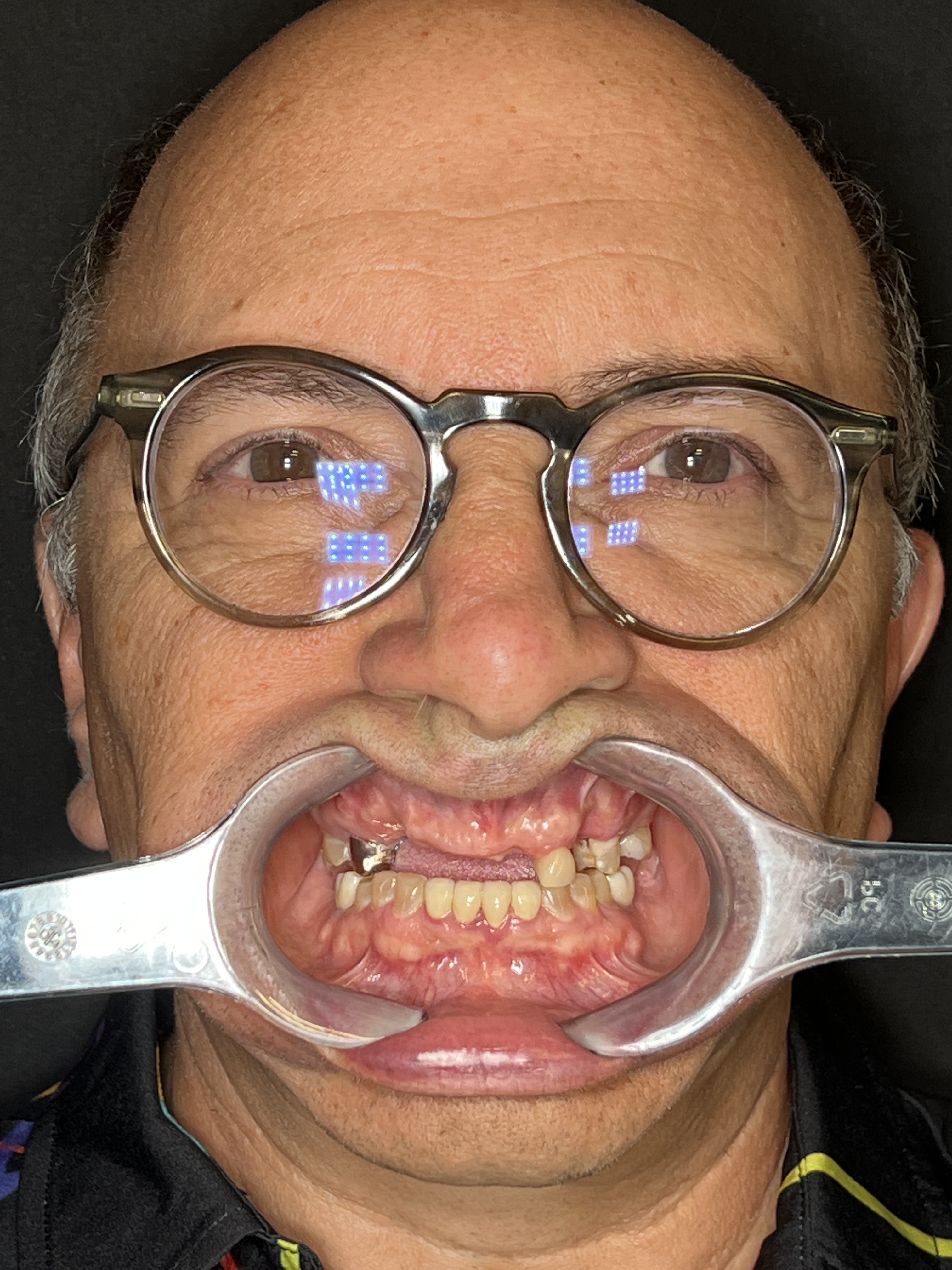 Teeth Contour Instance Segmentation Dataset And Pre Trained Model By