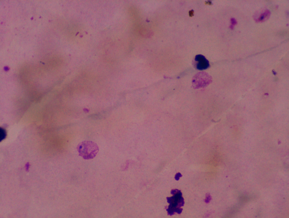 Andrew Malaria Project Object Detection Dataset by AndrewSteve