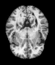 medical Object Detection Dataset and Pre-Trained Model by karpagam