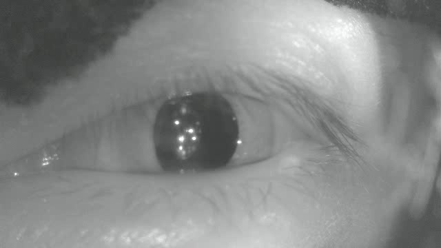 EYE Object Detection Dataset by Hw