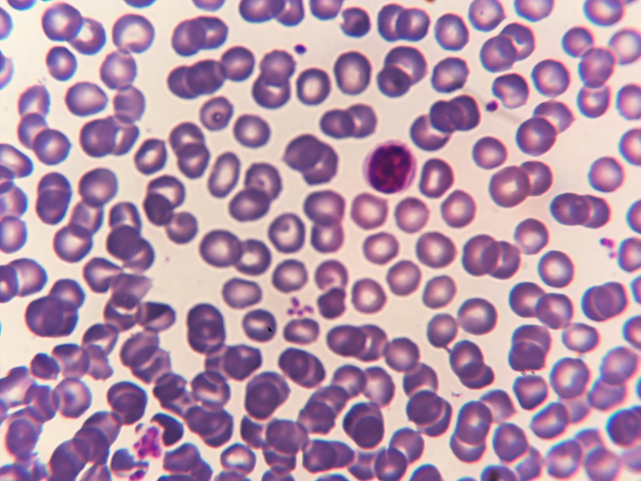 segemen1 Instance Segmentation Dataset by SABDI PRO