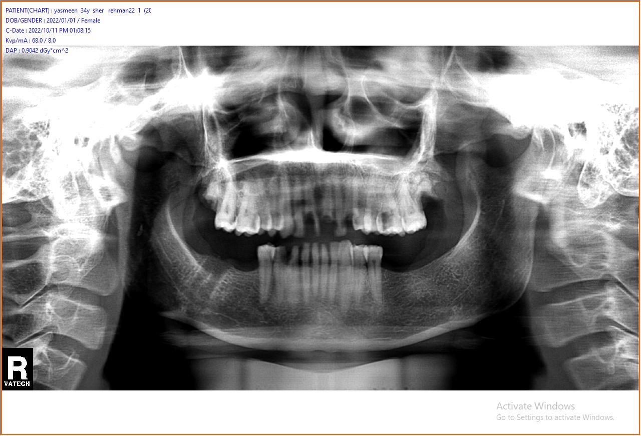 Xray Teeth Object Detection Dataset By Mwz