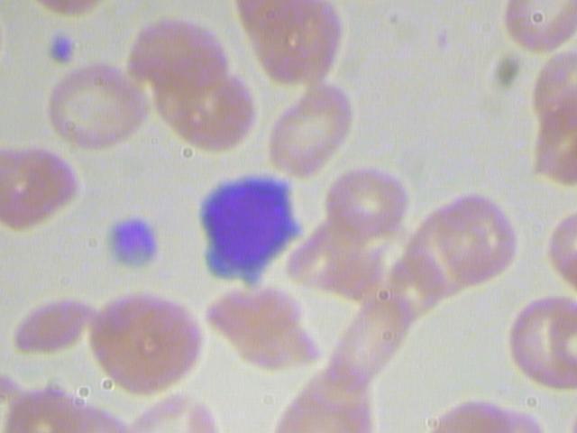 rbc wbc Object Detection Dataset by Amrita vishwa vidhyapeetam chennai