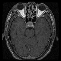 Preliminerary Run (Sartaj) Object Detection Dataset and Pre-Trained Model by Capstone
