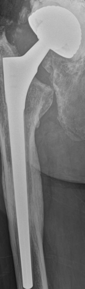 Cup angle3 Instance Segmentation Dataset by Cup angle