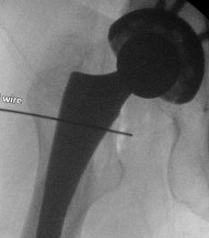 Cup angle - Roboflow Universe