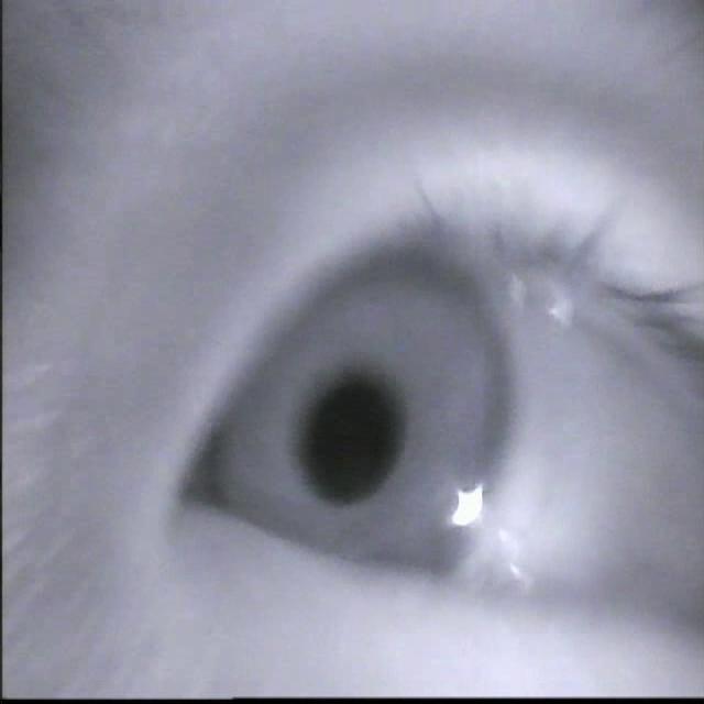 Dataset Pupil Detection Object Detection Model By Eyetracker