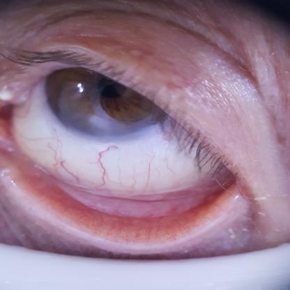 Anemia Detection Ultrasets Object Detection Dataset by Trien