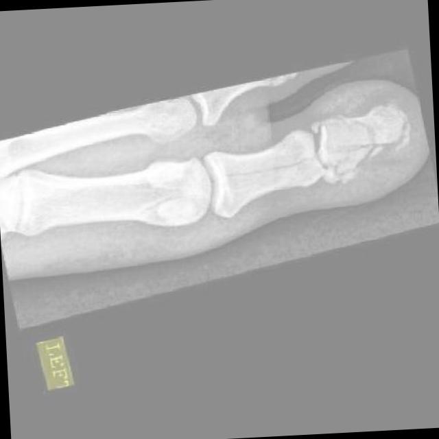 OsteoscanPro Object Detection Model by Abdullah