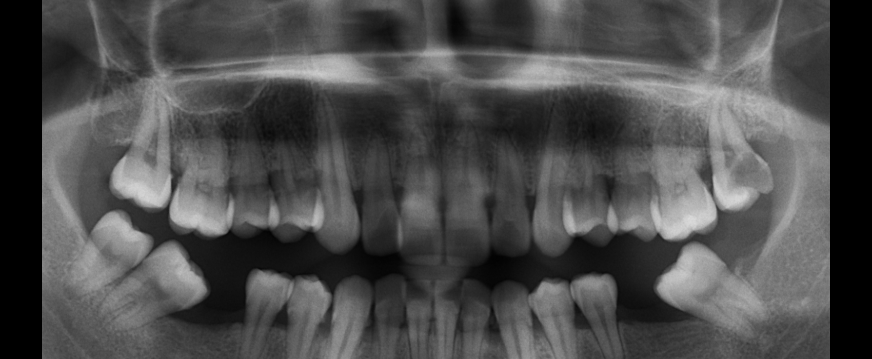 tooth_labeling Instance Segmentation Dataset and Pre-Trained Model by ysm