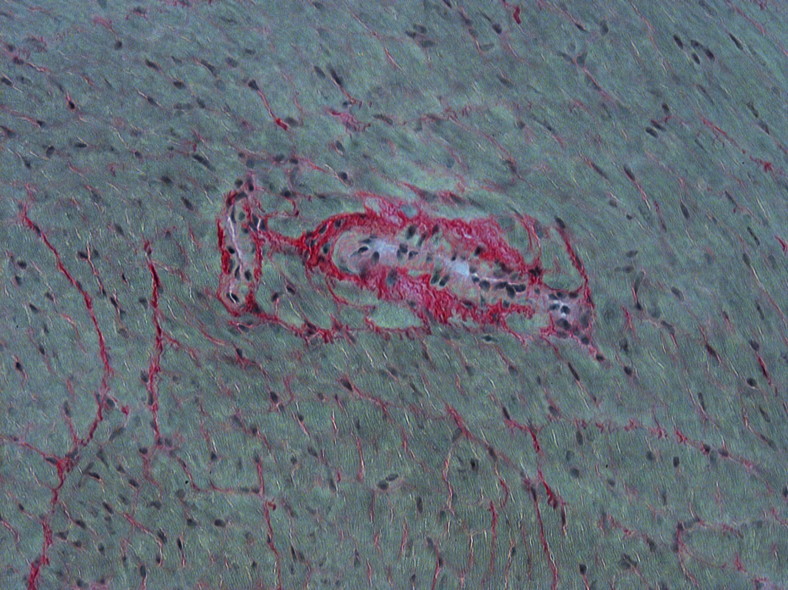 Blood_vessels Instance Segmentation Dataset by Anna